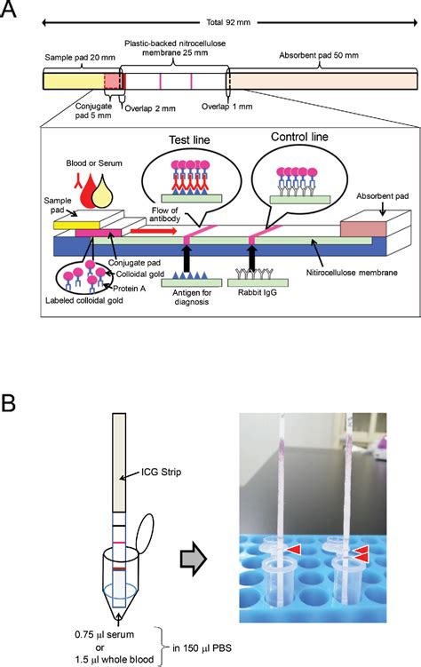 Figure 1 From Multiplex Immunochromatographic Assay For Serologic Diagnosis Of Major Infectious