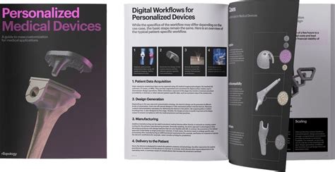 Designing Personalized Medical Devices