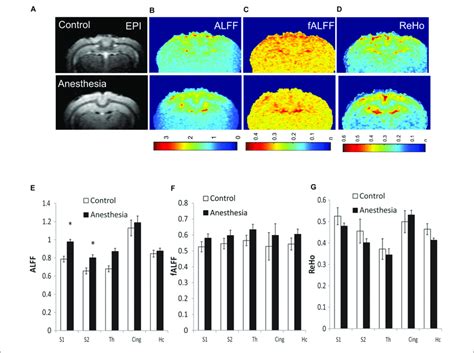 Representative Maps Of Regional Resting State Functional Rsfmri