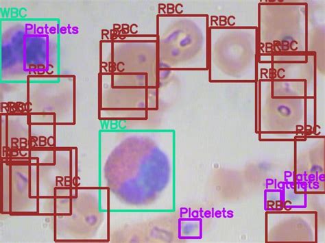 GitHub Mostafa Anwar Blood Cells Object Detection RetinaNet Train PyTorch RetinaNet On