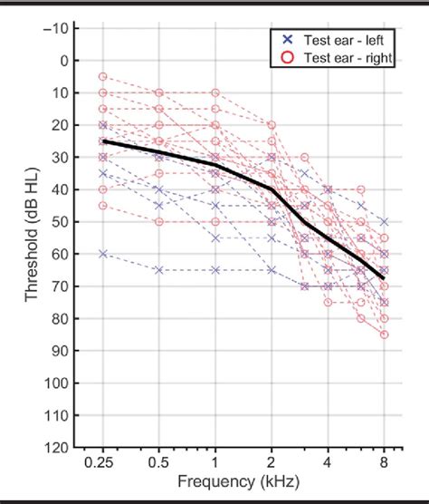 Figure 1 From Does The Speech Cue Profile Affect Response To Amplitude Envelope Distortion