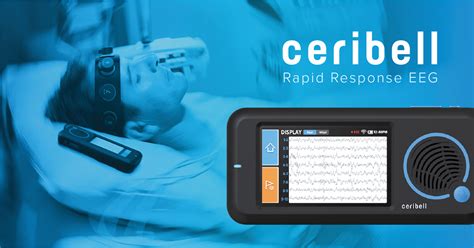 Smc First In State To Launch Ceribell Rapid Eeg Brain Monitoring