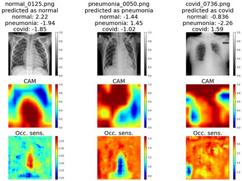 Network Interpretability Of Lung X Rays — Xaitk Saliency 0120 Documentation
