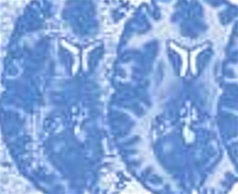 Best Neuroscience Courses Online With Certificates [2024] Coursera