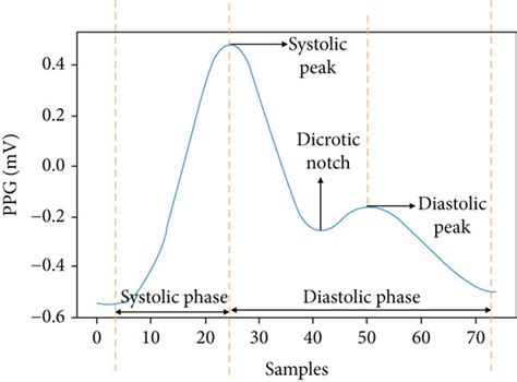 An Ideal Single Photoplethysmogram Ppg Signal Download Scientific