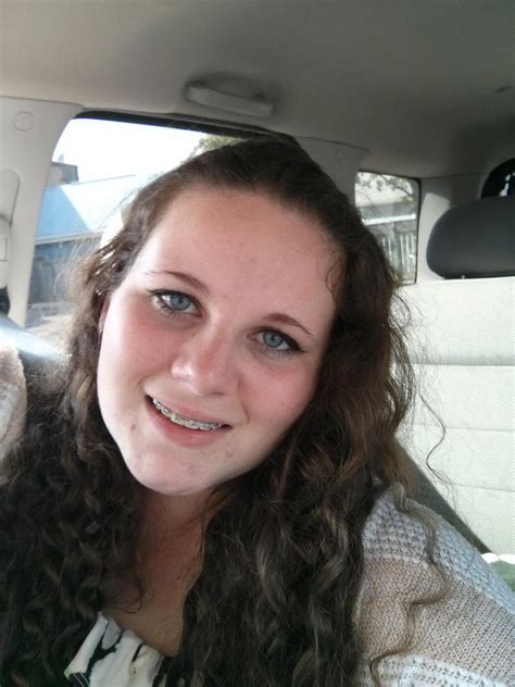 Brace Face By Kaleywhalie On Deviantart