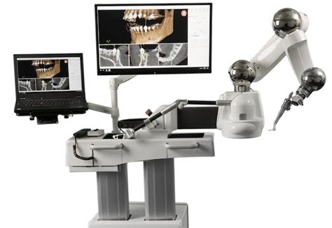 Neocis Celebrates 10 000 Implant Milestone With Yomi Robot