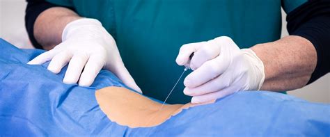 Are Facet Joint Injections Right For You