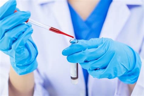 실험실 바이러스 분석에서 혈액 샘플을 분석하는 기술자 과학자 19에 대한 스톡 사진 및 기타 이미지 19 Dna Stem 주제 Istock