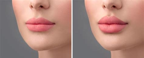 Consejos Para Labios Más Gruesos ¡aprende Cómo Lograrlo Doncomo ️