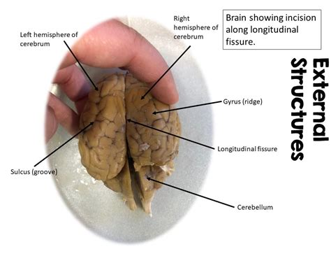 The Ultimate Guide To Sheep Brain Dissection Labeled Images Videos