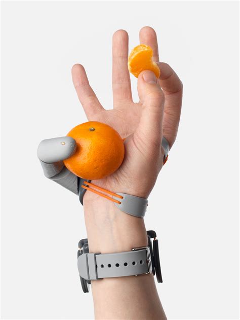 Arm Prosthetics Guide Introduction To Body Powered Prostheses Wknvrc