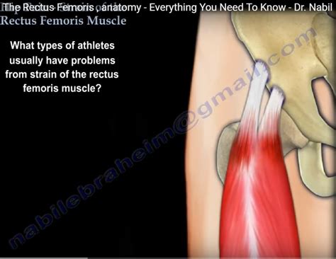 Rectus Femoris Strain And Hip Pain OrthopaedicPrinciples Com