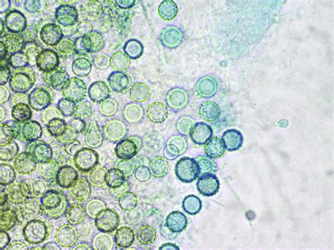 Mycological Culture Histoplasma Capsulatum Mold Phase From Culture Download Scientific