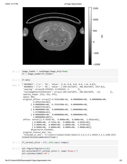 Ai Wholebody Organ Segmentation Devpost
