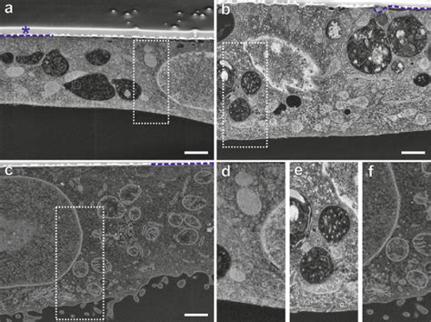 Optimization Of Membrane Staining For Fib Sem Cells Are Embedded