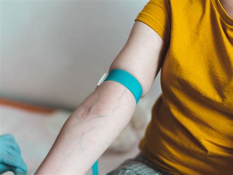 Green Veins Why Theyre That Color Plus Conditions To Be Aware Of