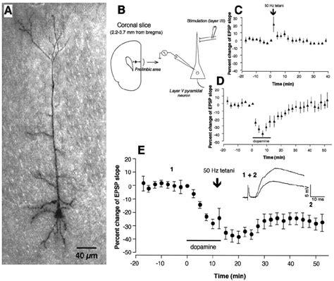 Dopaminergic Facilitation Of Ltd Induction In Layer I Ii To Layer V