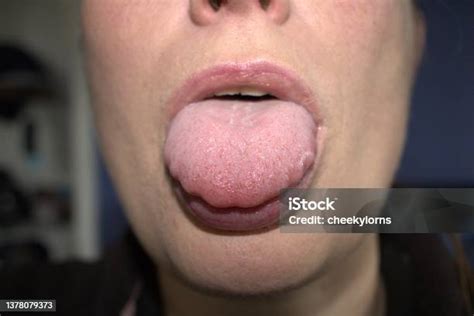 물결 모양의 잔물결 가리비 가장자리와 부풀어 오른 흰색 혀 혀에 대한 스톡 사진 및 기타 이미지 Istock