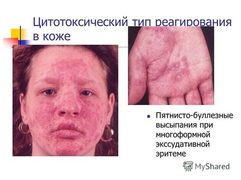 Презентация на тему Иммунодерматология Доцент Алексеев М Е Основные функции кожи Иммунная