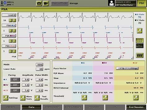 Latitude™ Programming System Model 3300 Boston Scientific