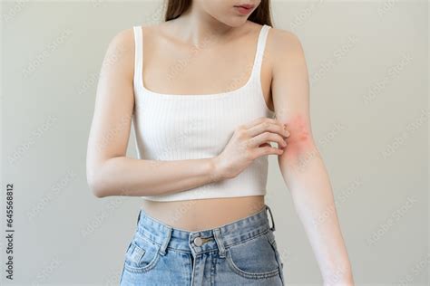 Dermatology Asian Young Woman Girl Allergy Allergic Reaction From Atopic Insect Bites On Her
