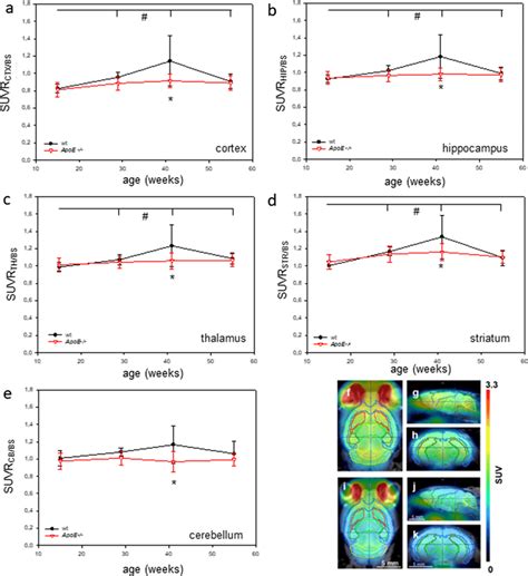 Target To Brain Stem Ratio Of ¹⁸f Fdg Uptake In The Cortex Download Scientific Diagram