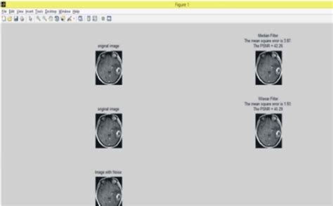 Wiener And Median Filter Output Download Scientific Diagram