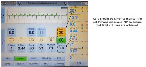 Volume Targeted Ventilation Indication And Use In The Neonatal Unit Nhsggc