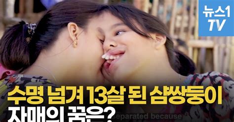 [영상] 수명 10년 선고 13살 된 샴쌍둥이 자매 분리 수술 하고 싶어요