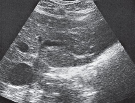 Liver Diagram Quizlet