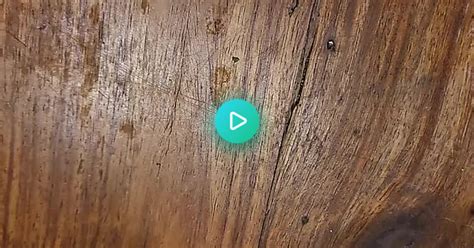 Partial Nail Removal Album On Imgur