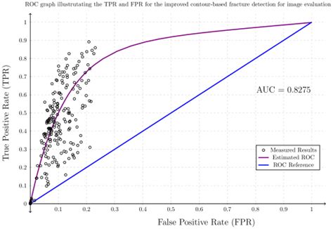 Long Bone Fracture Detection Using Artificial Neural Networks Based On