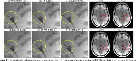 Table 1 From Brain Mri Super Resolution Using 3d Deep Densely Connected Neural Networks