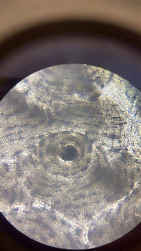 Compact Bone Diagram Quizlet
