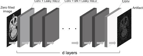 Figure 1 From Reconstruction Of Compressed Sensing Mr Imaging Using Deep Residual Learning In