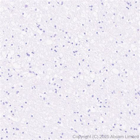 兔specific Ihc Polymer Detection试剂盒hrpdab Ab209101 Abcam中文官网