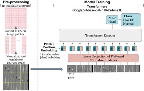 Deep Learning For Electrocardiograms Insights A Comparative Study Of Network Architectures Deep Learning For Electrocardiograms Insights A Comparative Study Of Network Architectures