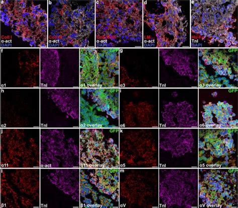 Extracellular Matrix And Integrin Expression In Beating Areas From Download Scientific Diagram