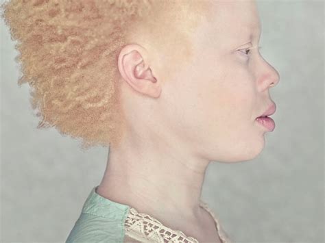 Photographers Capture The Unique Beauty Of Albino People And People Cant Stop Loving Them
