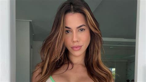 Foto Ex Bbb Larissa Tom Sia Mostra Resultado Ap S Procedimento Est Tico Purepeople