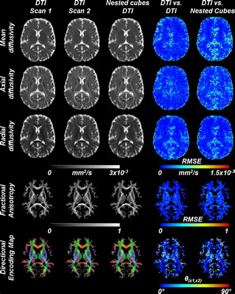 Simultaneous Acquisition Of Diffusion Tensor And Dynamic Diffusion Mri