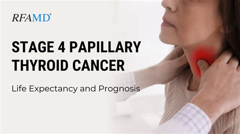 How Is Papillary Thyroid Cancer Treated Rfamd