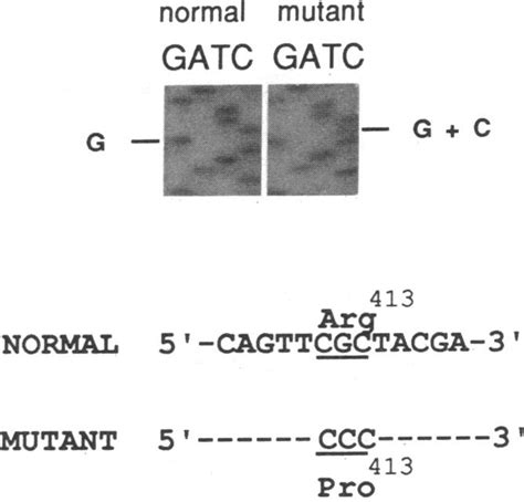 Identification Of The Missense Mutation In Exon 12 Of The Human Pah Download Scientific Diagram