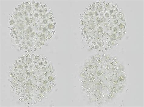 Genus Chroococcus Waarneming Nl