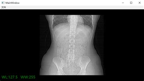 Dicom Image Viewer Is A Simple Free Dicom Viewer For Windows