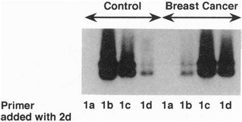 Southern Analysis Of Switching Of Tissue Specific Exons 1 In Breast Download Scientific Diagram