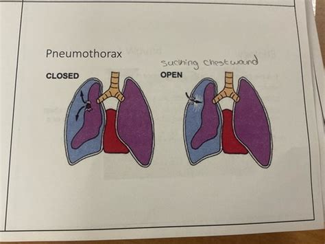 Rtpp 05 Flashcards Quizlet