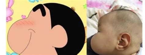 现实中竟真有，蜡笔小新的嘴巴嘟嘟脸！灵感来源于生活，真没错 蜡笔小新 嘴巴 灵感 新浪新闻