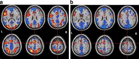 Fmri Results To The Control Group Bold Activation Red And Download Scientific Diagram